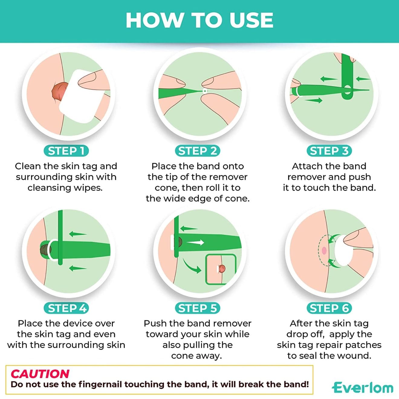 Painless Skin Tag Removal Kit for Small (2mm) to Medium (5mm) Skin Tags ...